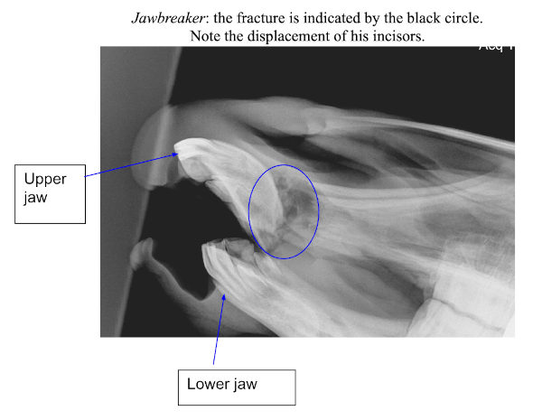 Maxillary Jaw Fracture